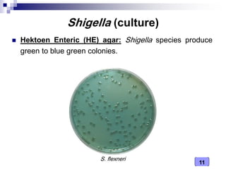 Medical Microbiology Laboratory (Enterobacteriaceae - IV) | PPT