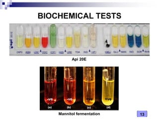 Medical Microbiology Laboratory (Enterobacteriaceae - IV) | PPT