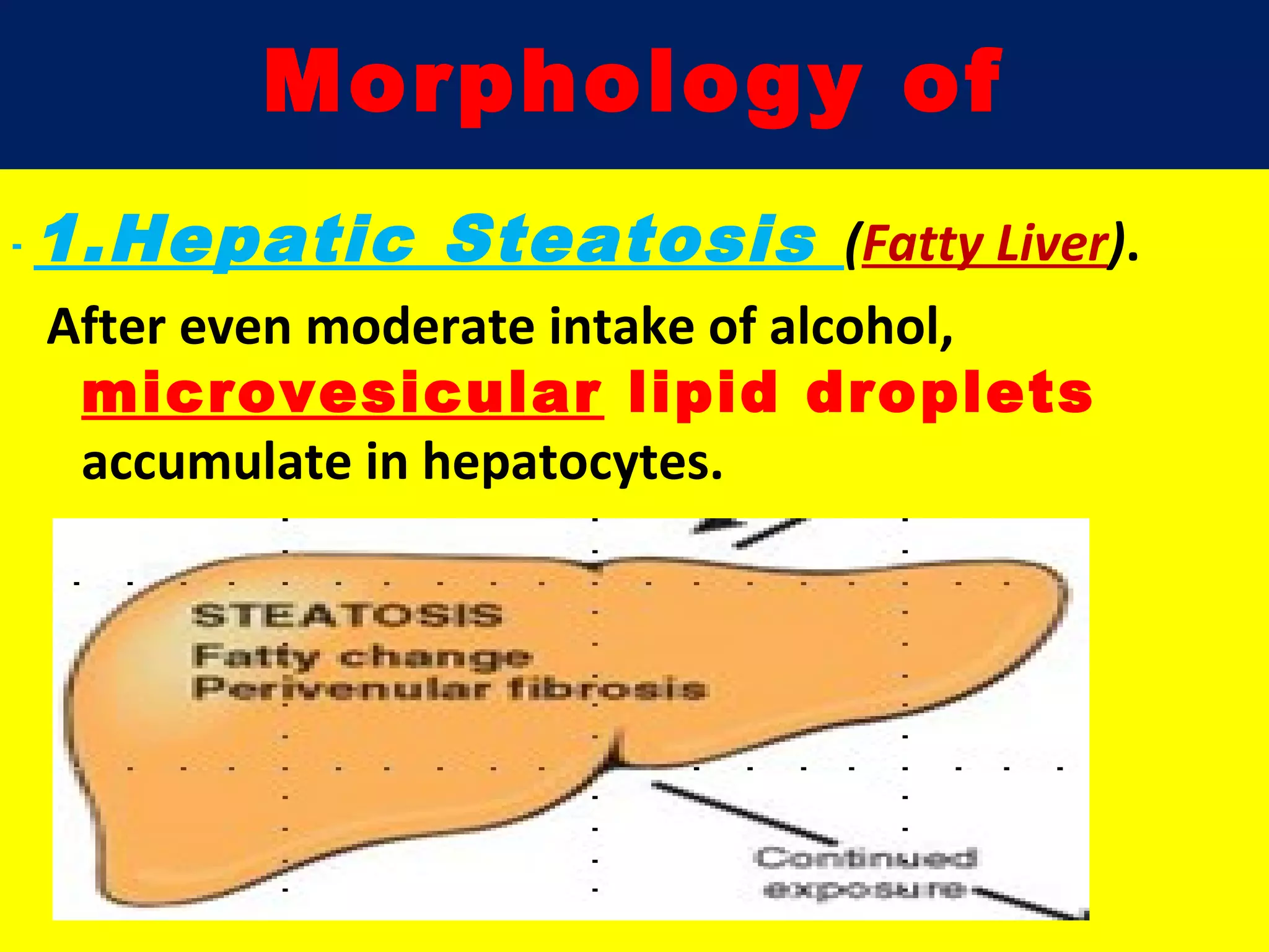 L24 alcoholic liver disease | PPT