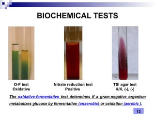 Medical Microbiology Laboratory (Pseudomonas spp.) | PDF