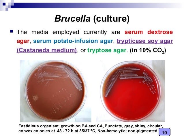 Medical Microbiology Laboratory (Brucella spp.)