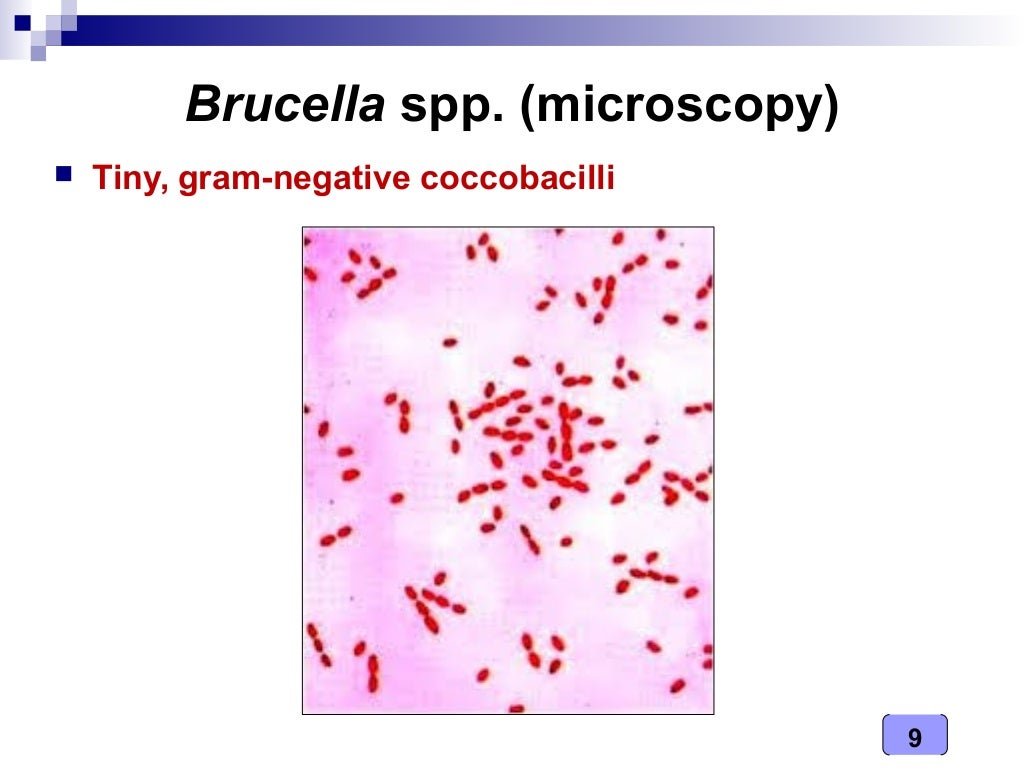 Medical Microbiology Laboratory (Brucella spp.)