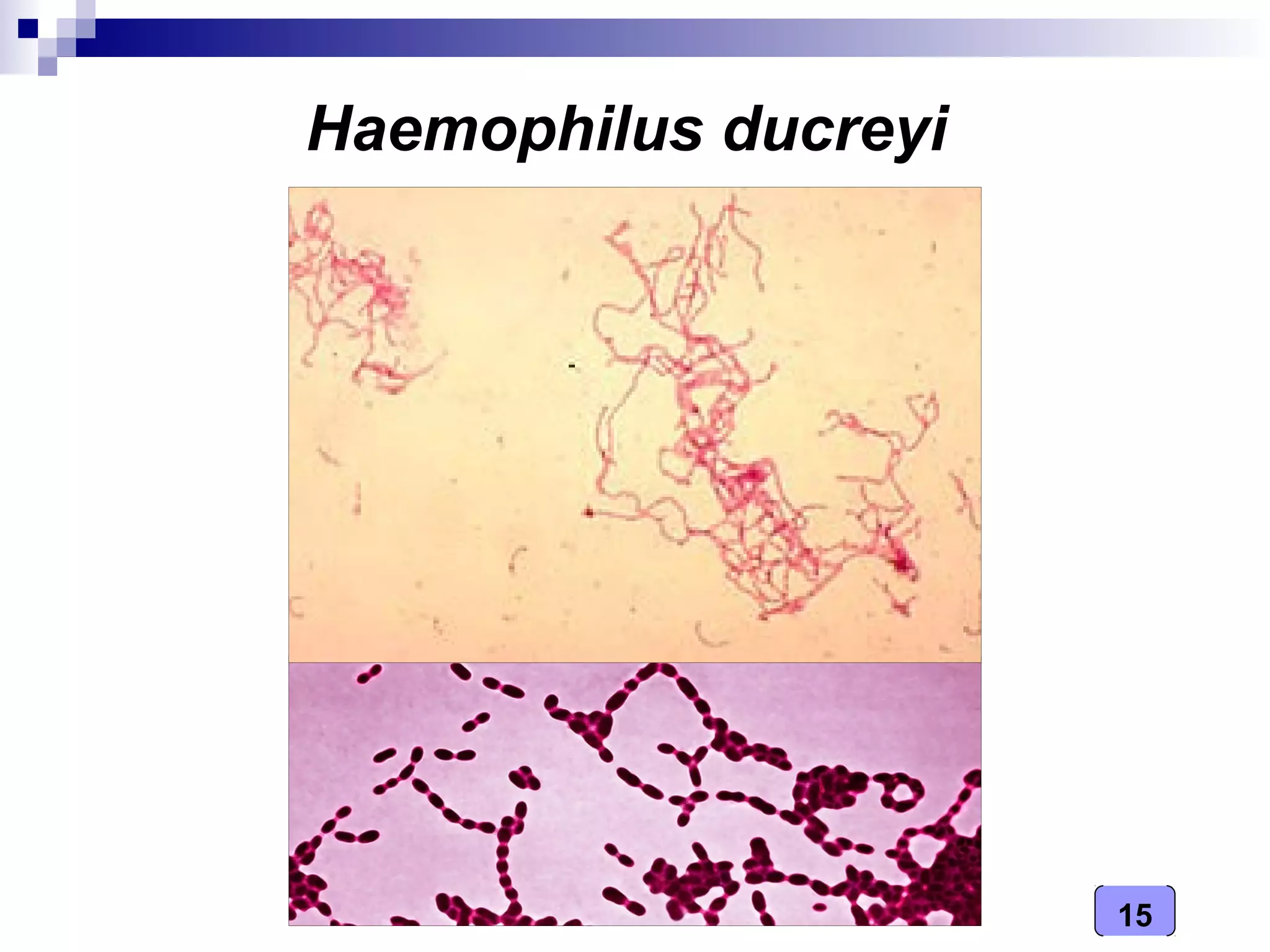 L27 - Medical Microbiology Laboratory (Haemophilus spp.) | PDF