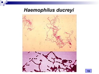L27 - Medical Microbiology Laboratory (Haemophilus spp.) | PDF