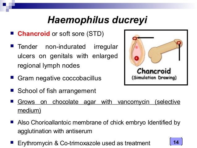L27 - Medical Microbiology Laboratory (Haemophilus spp.)