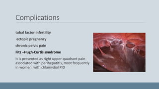 L46 Pelvic Inflammatory Disease (PID) | PPT