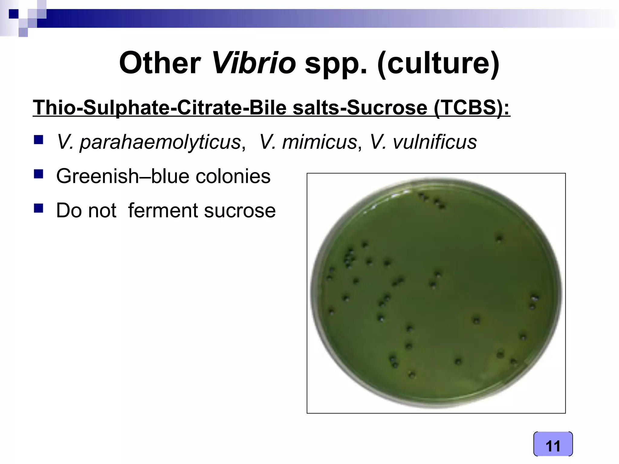 Medical Microbiology Laboratory (Vibrio spp.) | PDF