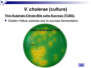 Vibrio Cholerae Tcbs