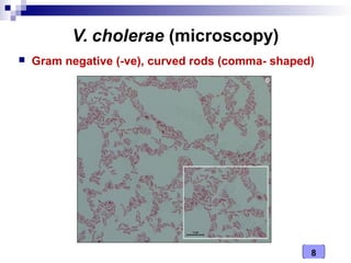 Vibrio Cholerae Gram Stain
