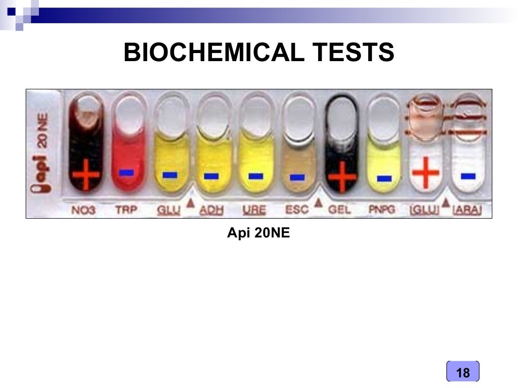 Medical Microbiology Laboratory (Vibrio spp.)