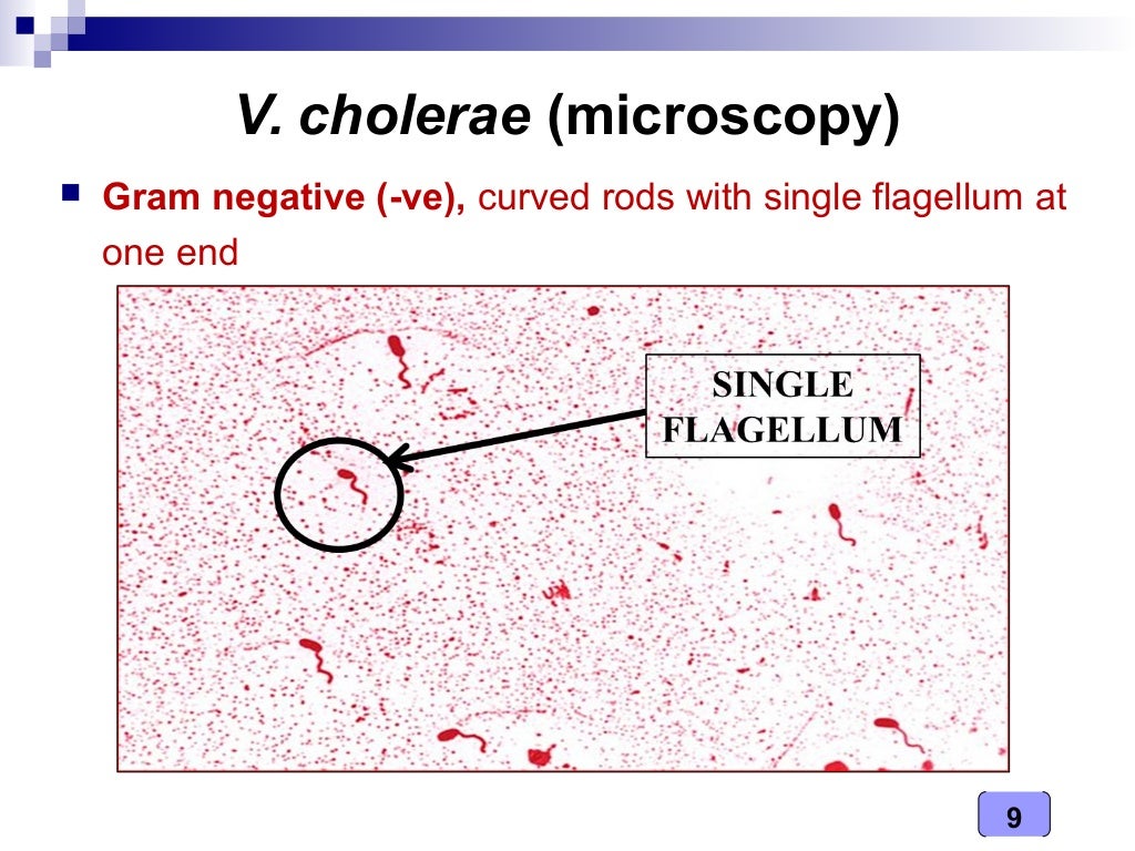Medical Microbiology Laboratory (Vibrio spp.)