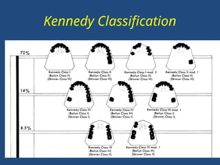 L2 classification (1).pptxL2 classification (1).pptx