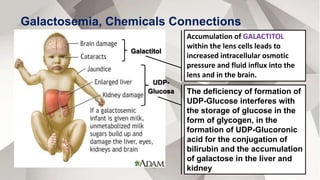 GALACTOSEMIA ASCORBATE OBESITY.pptx
