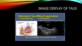 L2 Gynaecological usg (TAUS part 2).pptx