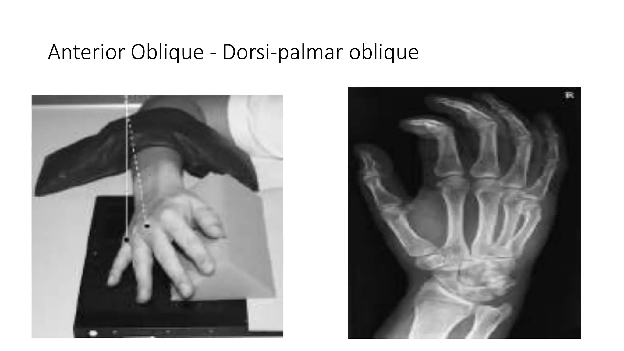 L2 Hand.pptxL2 Hand.pptxL2 Hand.pptxL2 Hand.pptx