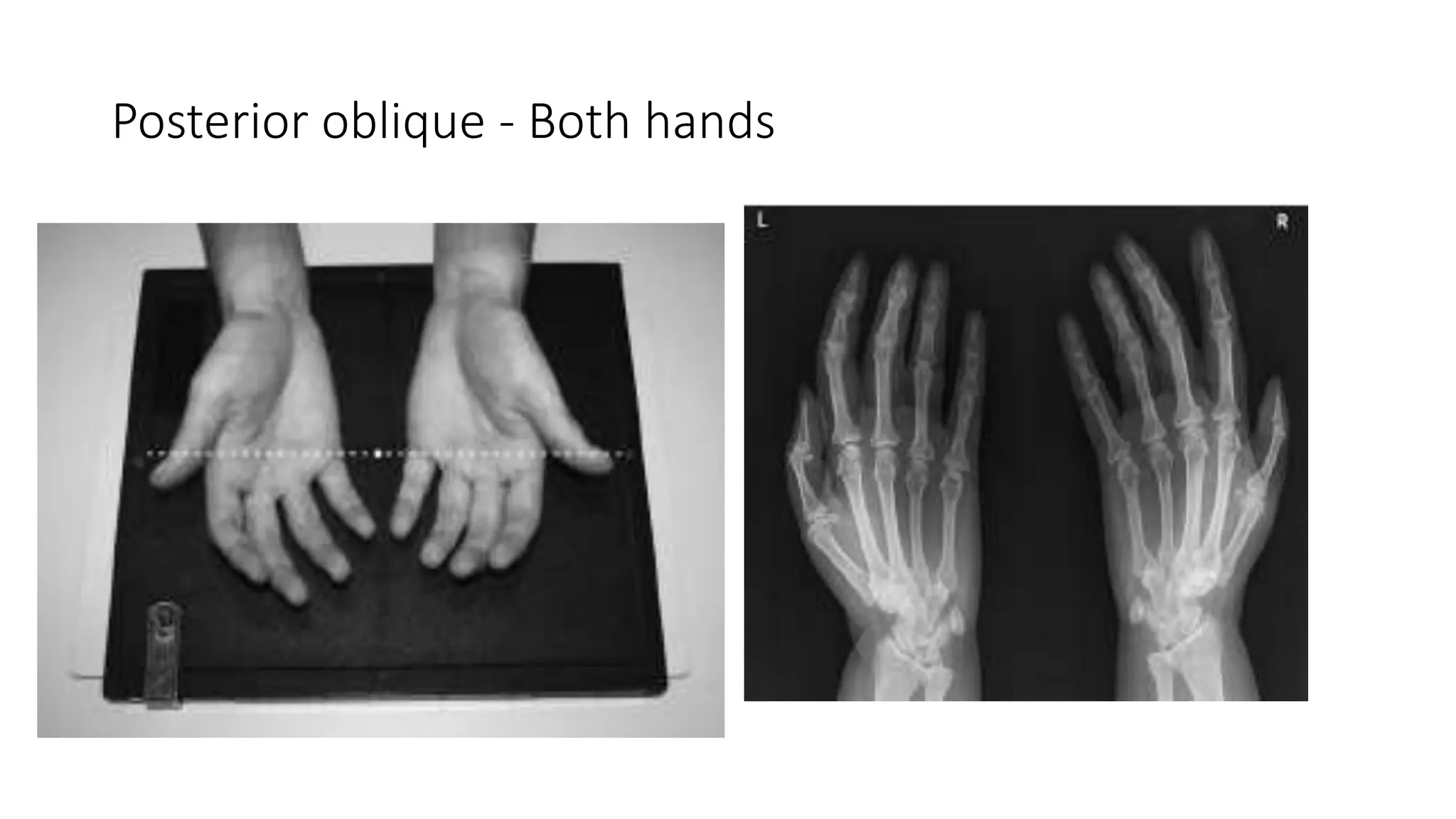L2 Hand.pptxL2 Hand.pptxL2 Hand.pptxL2 Hand.pptx