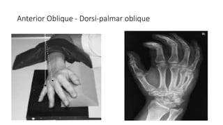 L2 Hand.pptxL2 Hand.pptxL2 Hand.pptxL2 Hand.pptx