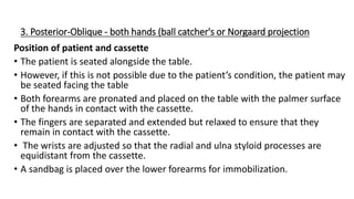 L2 Hand.pptxL2 Hand.pptxL2 Hand.pptxL2 Hand.pptx