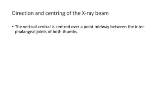 L2 Hand.pptxL2 Hand.pptxL2 Hand.pptxL2 Hand.pptx