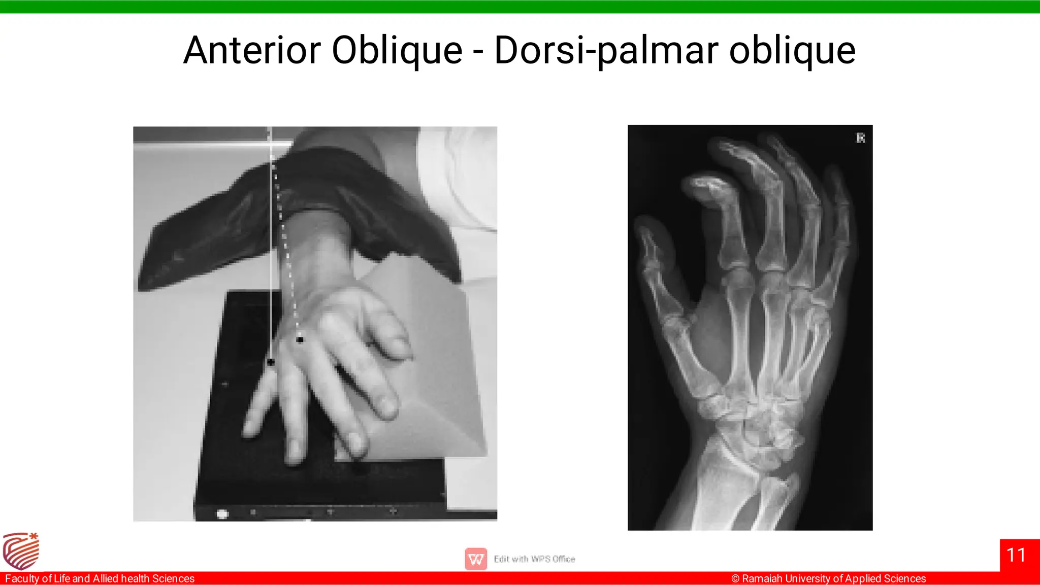 Positioning & tech Explain and Demonstrate The Radiographic positioning ...