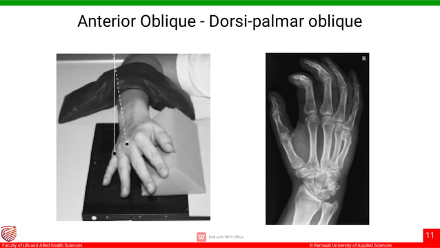 Positioning & tech Explain and Demonstrate The Radiographic positioning ...