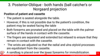Positioning & tech Explain and Demonstrate The Radiographic positioning ...
