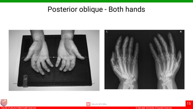 Positioning & tech Explain and Demonstrate The Radiographic positioning ...