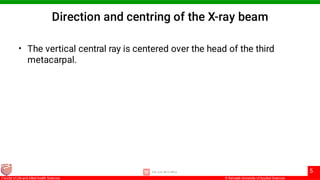 Positioning & tech Explain and Demonstrate The Radiographic positioning ...