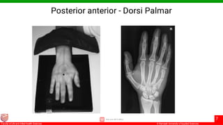 Positioning & tech Explain and Demonstrate The Radiographic positioning ...