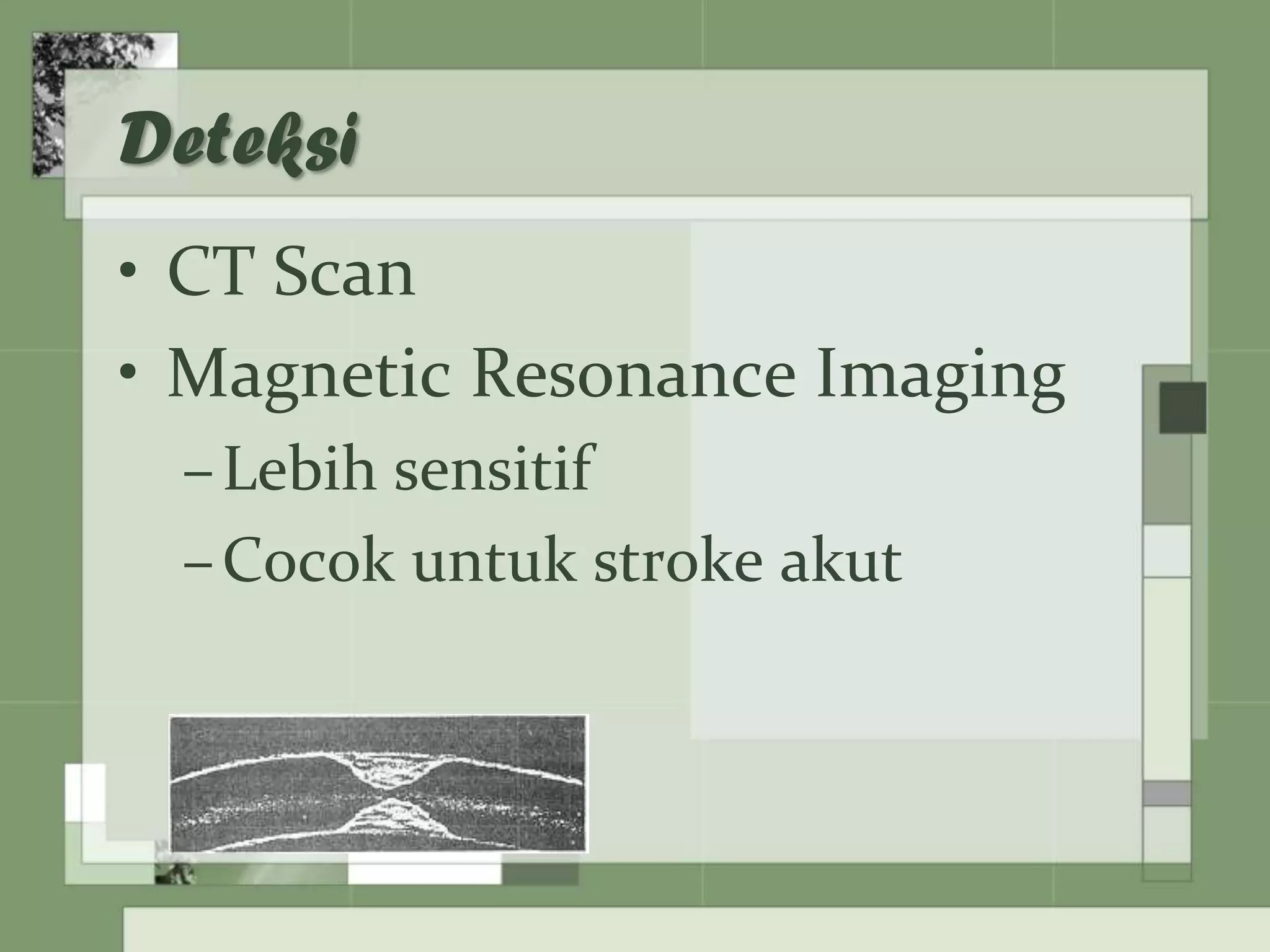 Penyakit Stroke | PPTX