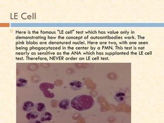 Systemic lupus erythromytosis .ppt