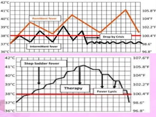 L 3 4.approach to fever | PPT