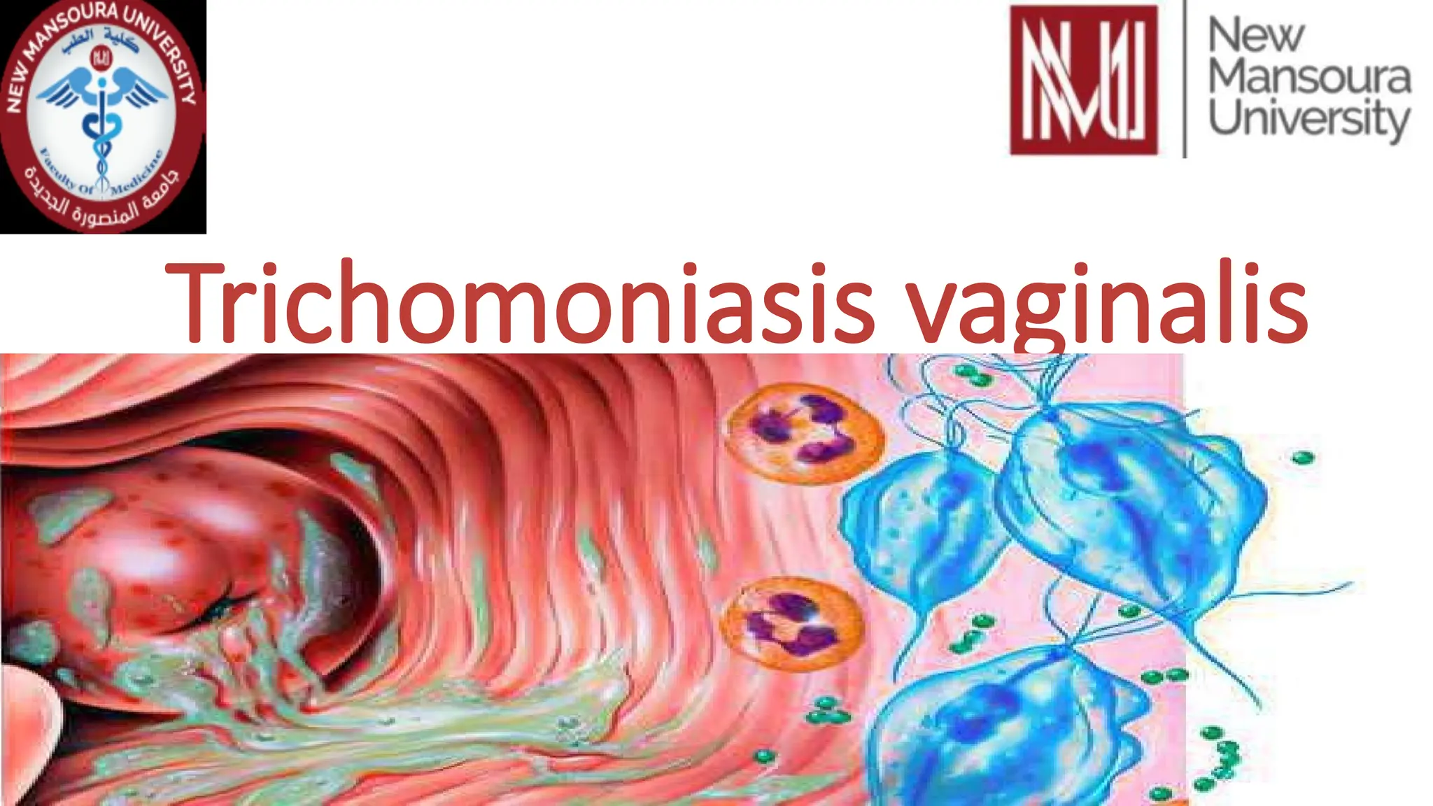 L30- (Para power-2) Trichomoniasis & Carcinogenic GUP .pptx