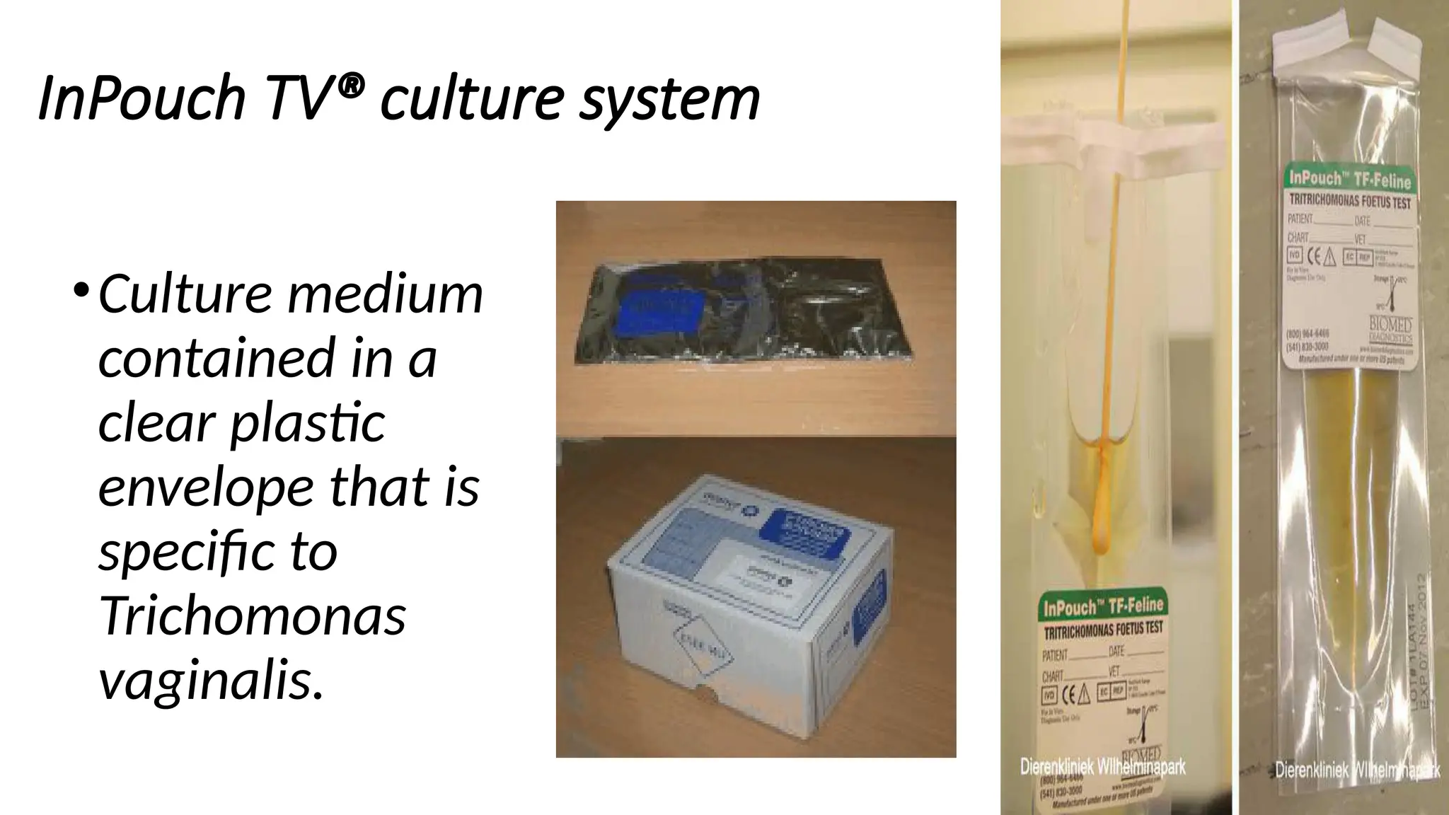 L30- (Para power-2) Trichomoniasis & Carcinogenic GUP .pptx