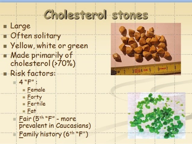 L30 gallstones student