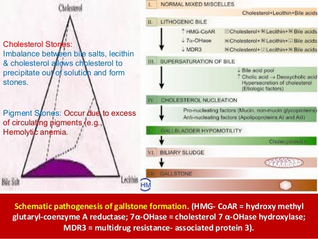 L30 gallstones student