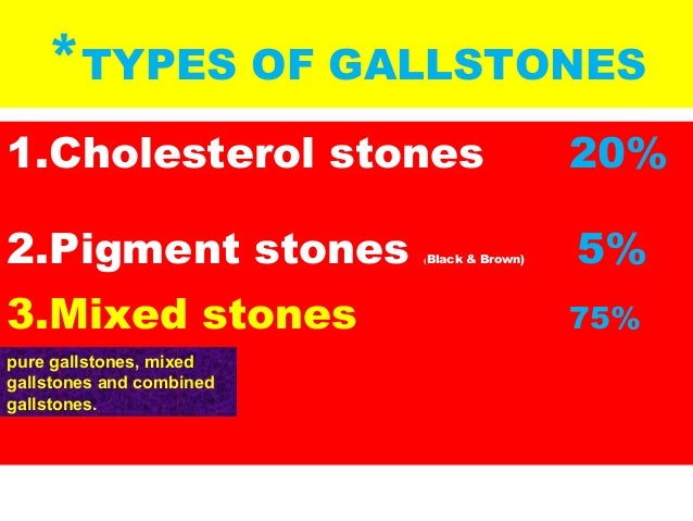 L30 gallstones student