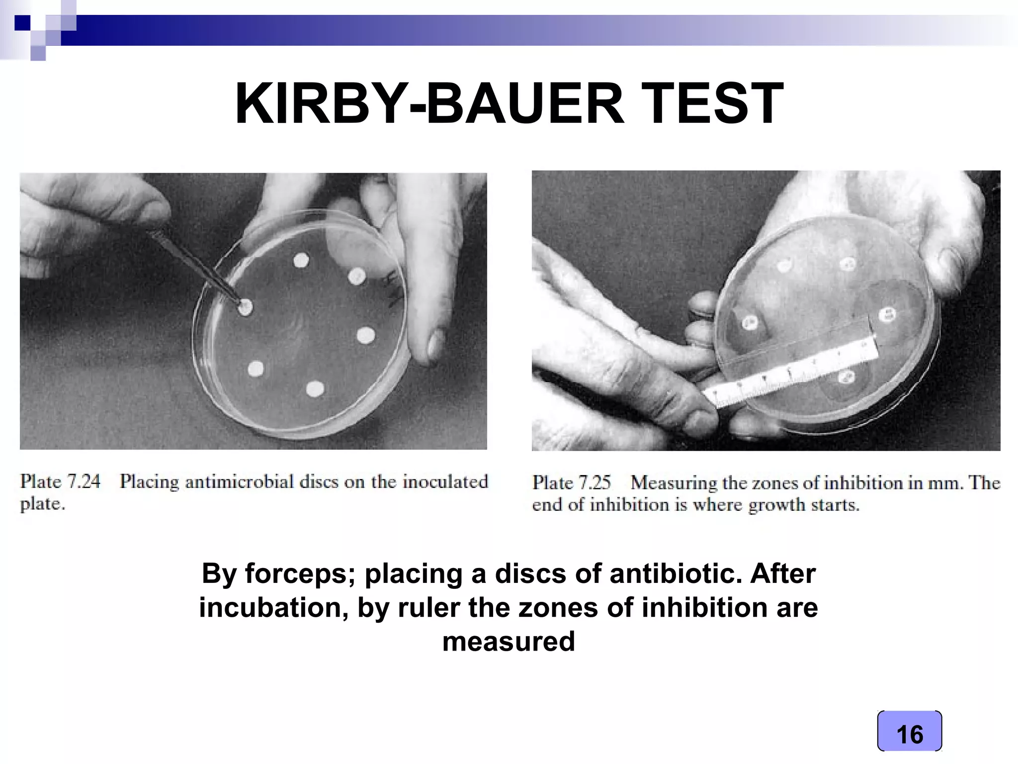 Medical Microbiology Laboratory (Antibiotics Sensitivity Testing) | PPT