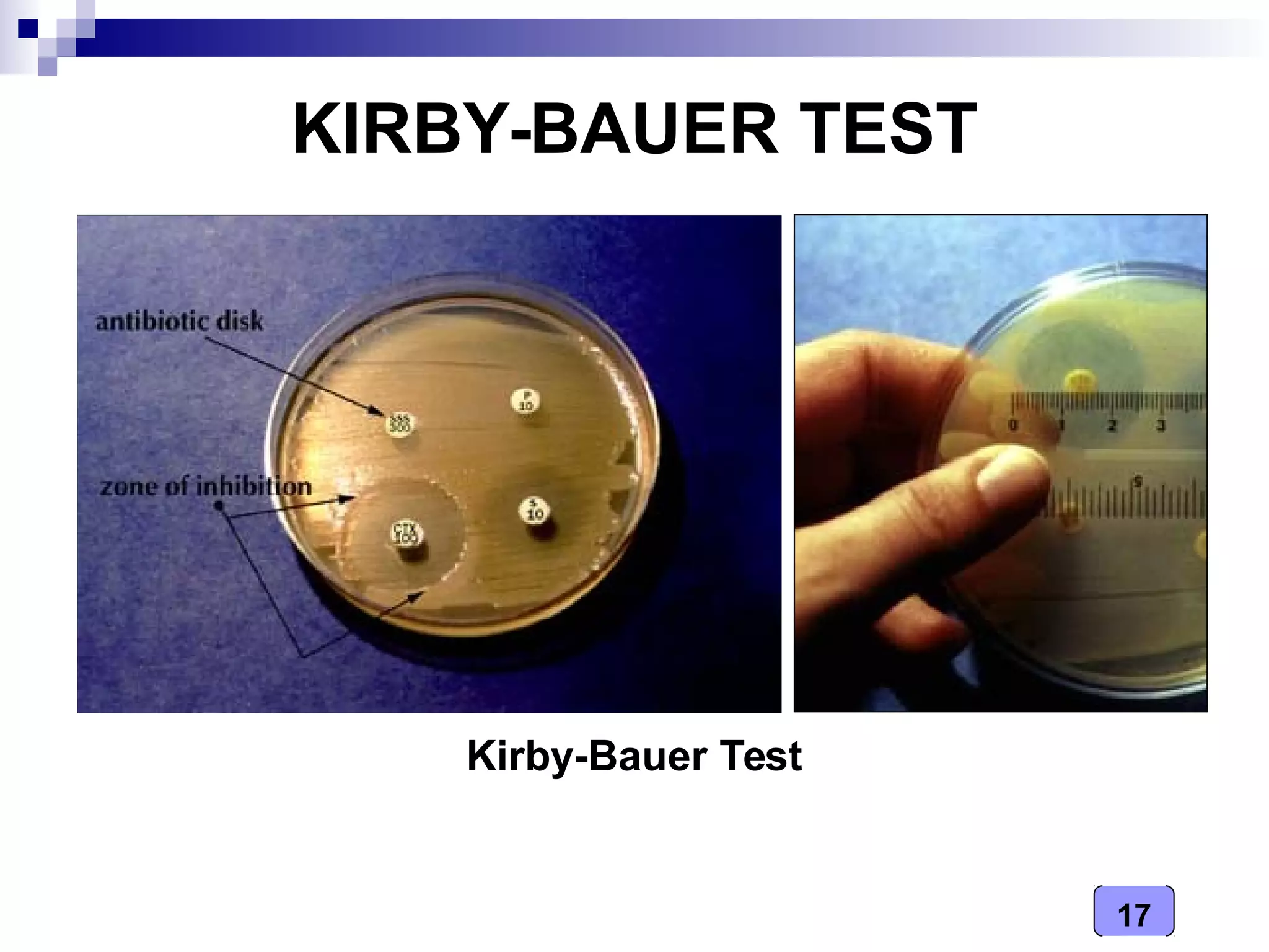 Medical Microbiology Laboratory (Antibiotics Sensitivity Testing) | PPT