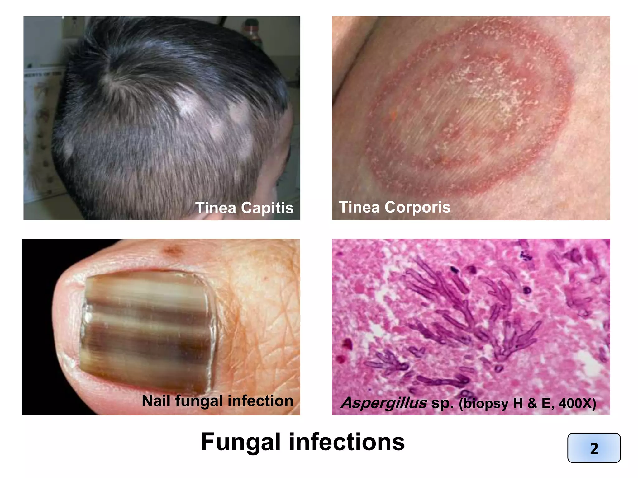 Medical Microbiology Laboratory (Introduction to Medical Mycology) | PDF