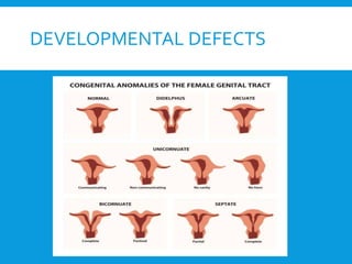 L45 Genital tract development and Puberty & their disorders | PPT ...