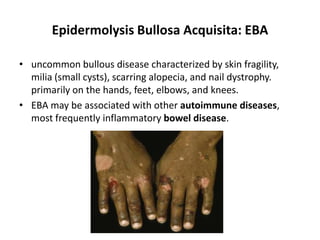 Dermatology 5th year, 3rd lecture (Dr. Faraedon Kaftan) | PPTX