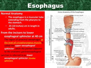 Proximal Vs Distal Esophagus