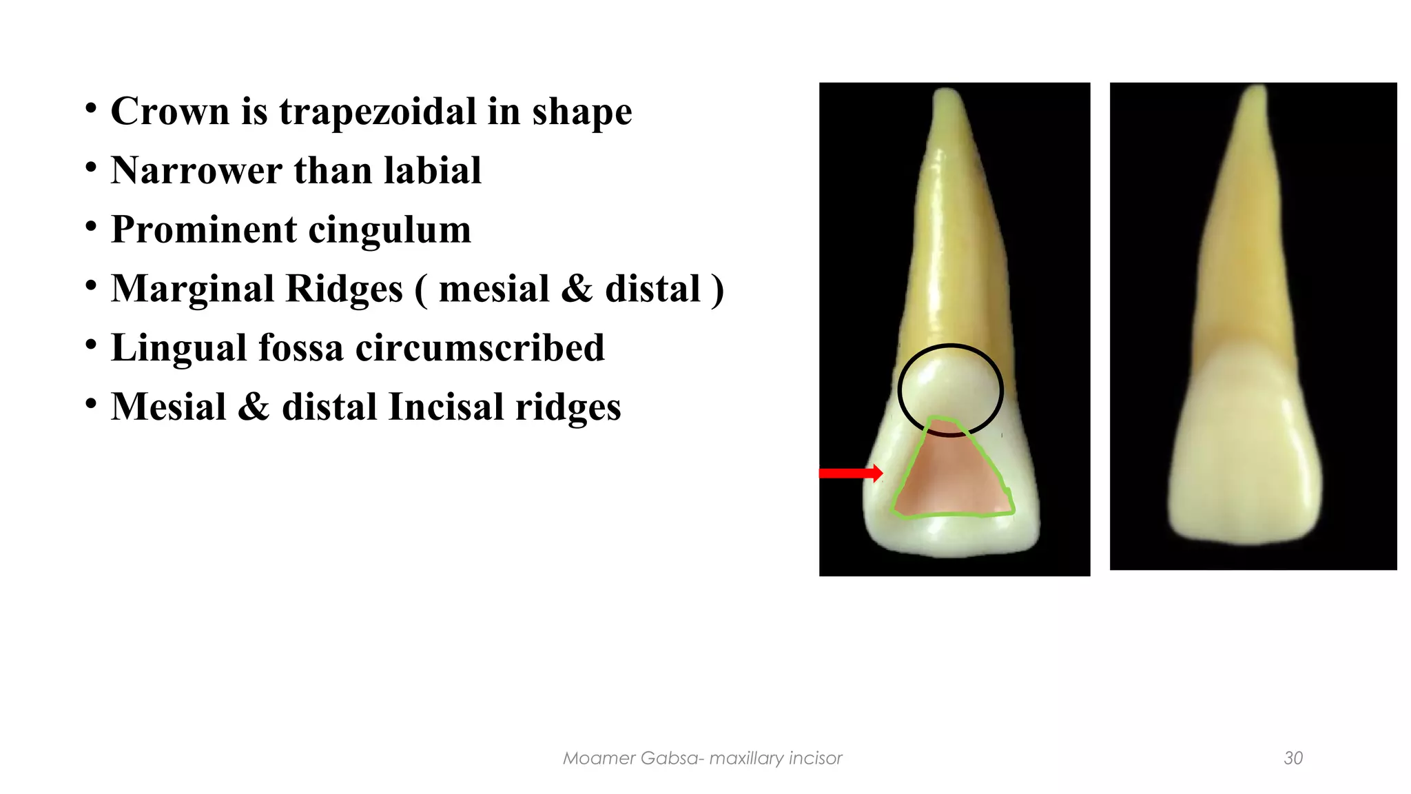 Morphology of maxillary incisor | PPT