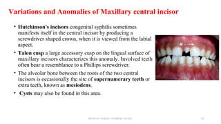 Morphology of maxillary incisor | PPT
