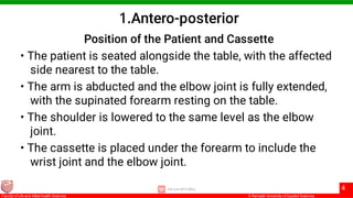 radiography of forearm from clarks positiong | PDF