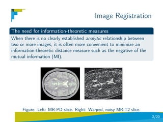 CVPR2010: Advanced ITinCVPR in a Nutshell: part 4: Isocontours ...