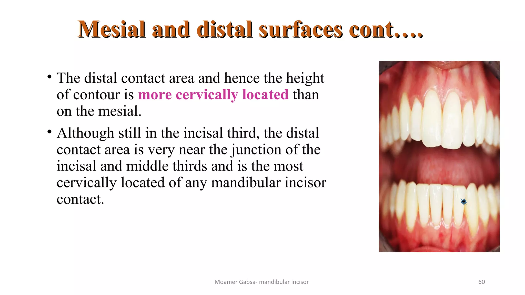 Morphology of mandibular incisors | PPT