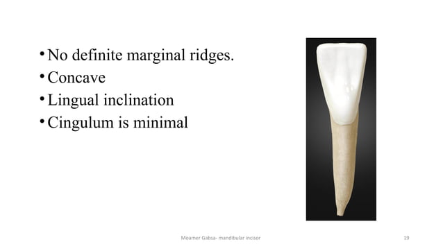 Morphology of mandibular incisors | PPT