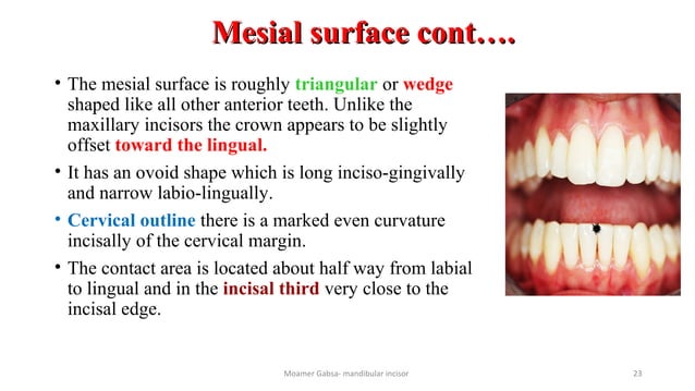 Morphology of mandibular incisors | PPT